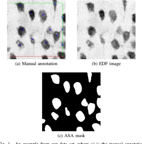 Figure 1 From Iterative Deep Learning Based Unbiased Stereology With