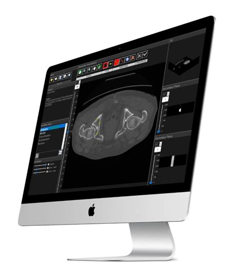 Mathworks On Linkedin Learn How Matlab Helps Treat Cancer By Tracking Targeting Tumors