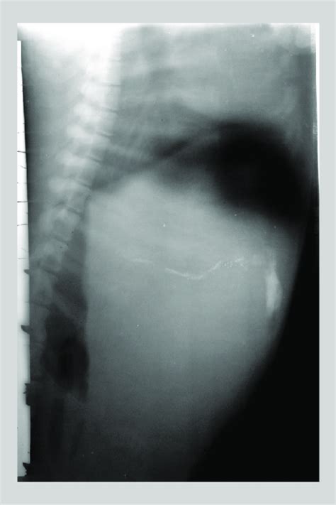 In Vivo Floating Behaviour Of Cellulose Acetate Microspheres Download Scientific Diagram