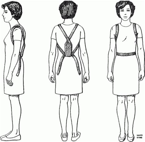 Back Extensor Strengthening Exercise And Osteoporosis Musculoskeletal Key
