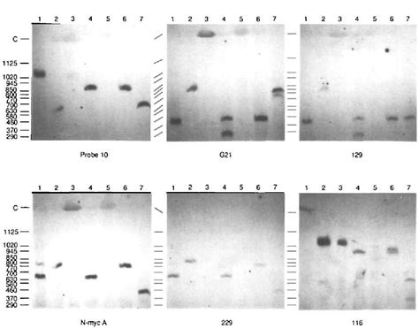 Figure 1 From Megabase Scale Analysis Of The Origin Of N Myc Amplicons In Human Neuroblastomas