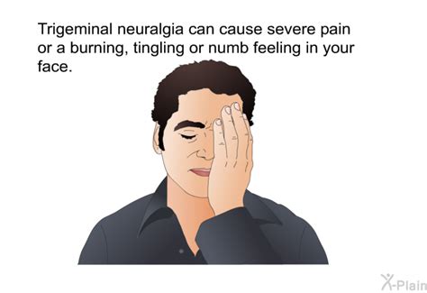 Trigeminal Neuralgia