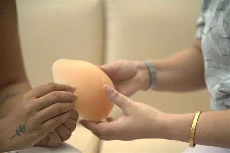 انواع پروتز سینه مقایسه مدل‌ های مختلف و راهنمای انتخاب