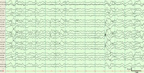 K Complex Alchetron The Free Social Encyclopedia