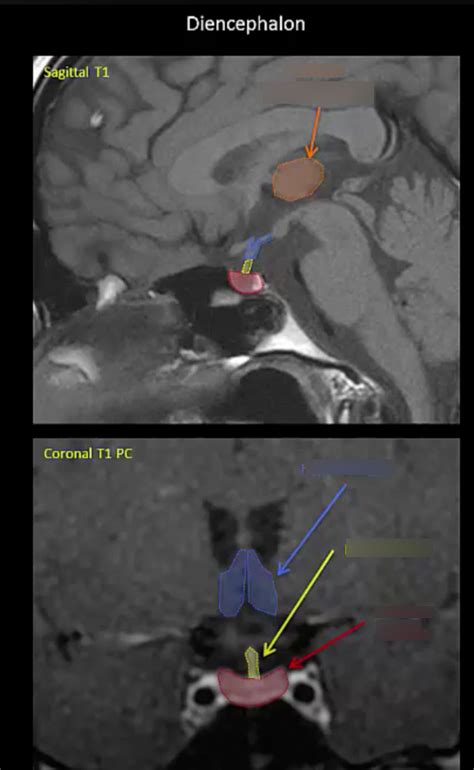 Diencephalon Diagram Quizlet