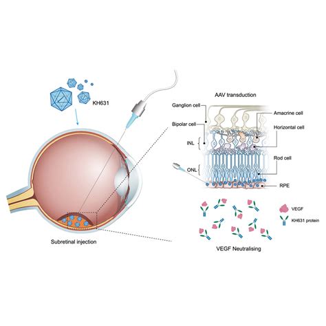 Preclinical Evaluation Of Kh631 A Novel Raav8 Gene Therapy Product For Neovascular Age Related