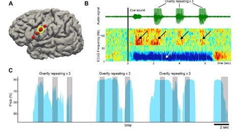 Example Of Functional Cortical Activity Underlying Overt Speech Download Scientific Diagram