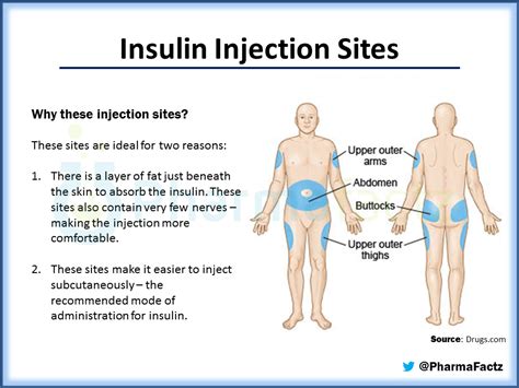 Insulin Injection Subcutaneous At Sebastian Bardon Blog