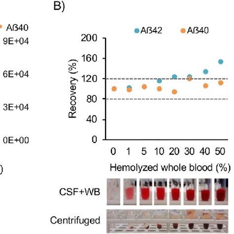 Bilirubin And Intralipid Interference Experiments A And C Average Peak Download Scientific