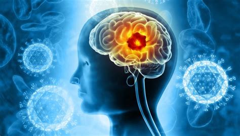 AI Improves Brain Tumor Detection Medical Clinics New York City