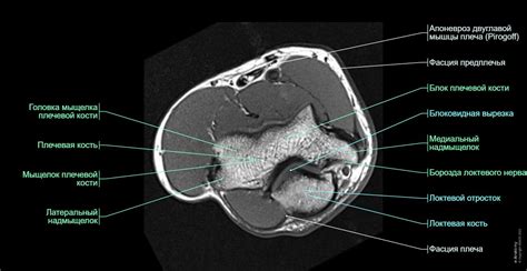 Локтевой сустав МРТ нормальная анатомия E Anatomy