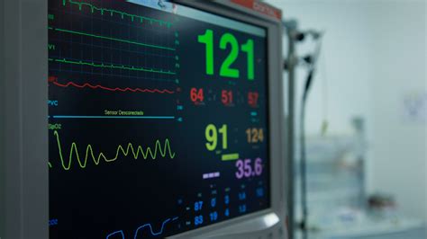 Positive Airway Pressure Adherence Mortality And Cardiovascular Events In Patients With Sleep