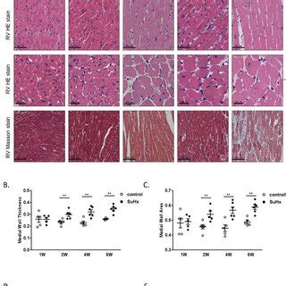Correlation Analysis Of RVSP And Echocardiographic Measurements RVEDWT Download Scientific