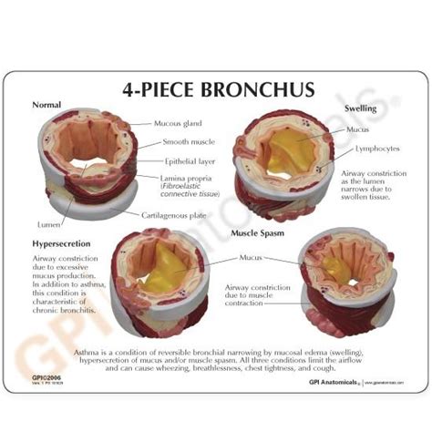 Cross Section Bronchus Model 4 Set Cross Section Bronchus Model