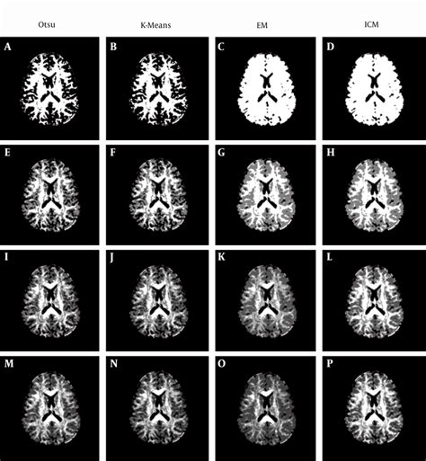 Clustering Maps Of An Fractional Anisotropy Image Using Different