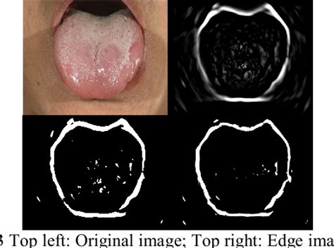 Figure 1 From Combination Of Polar Edge Detection And Active Contour Model For Automated Tongue