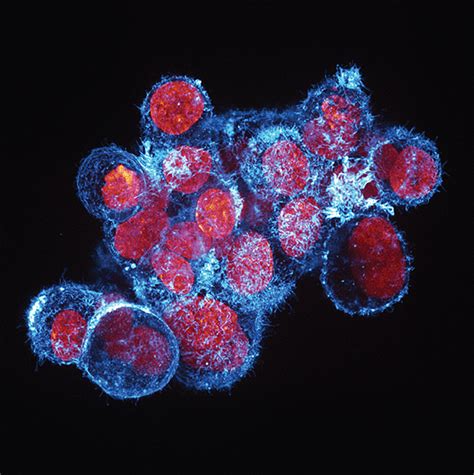 The Role Of Microenvironment In Brain Metastasis Australian Institute