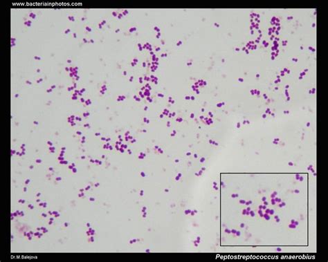 Gram Positive Cocci Microbiology Learning The Whyology Of Microbial Testing