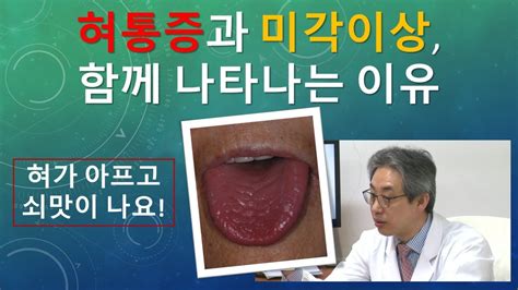 혀가 아프고 신맛이 심하다면 혀유두 버섯유두와 미뢰 구강작열감증후군에서 매운 음식 자극적 음식을 포함한 다양한 맛의 음식조절 원칙 Youtube