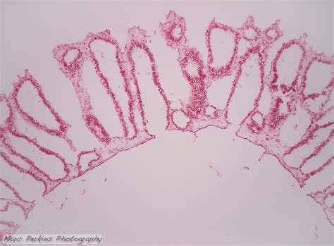 Scypha Spicules