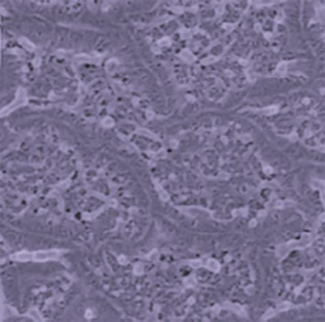 Mussel‐inspired Polydopaminepolystyrene Composites With 3d Continuous