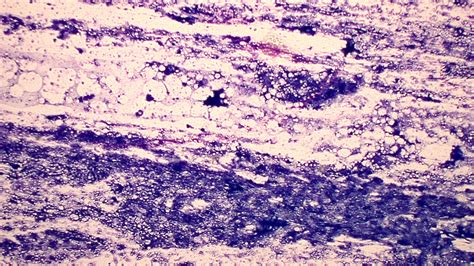 Artifacts Cytology Eclinpath