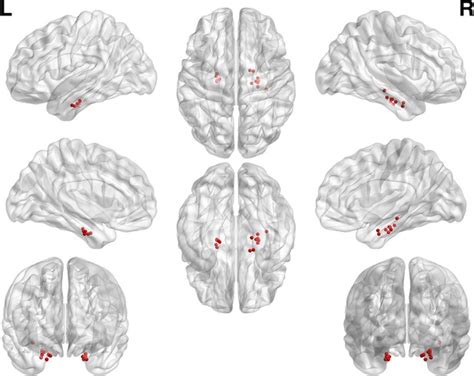 Figures And Data In Theta Burst Microstimulation In The Human Entorhinal Area Improves Memory