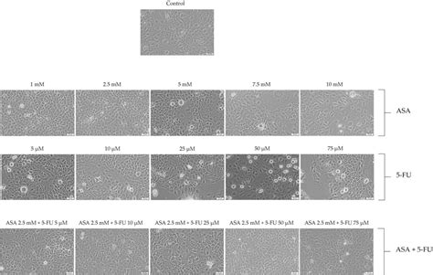 Figure 3 From In Vitro Assessment Of The Synergistic Effect Of Aspirin