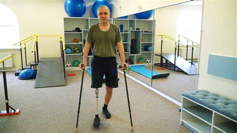 Протези в умовах війни скільки коштують та як їх отримати Читайте на Ukr Net