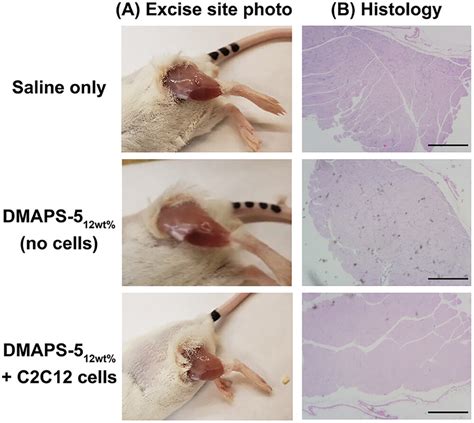 Injectable And Dynamically Crosslinked Zwitterionic Hydrogels For Anti‐fouling And Tissue