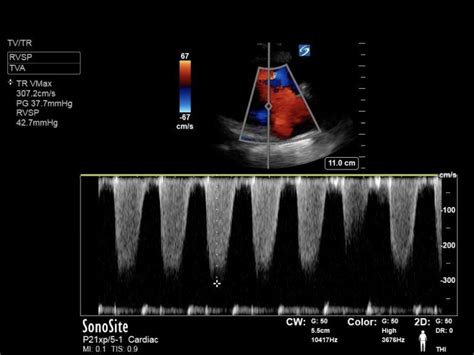 Rvsp How To Saving Lives With Sound