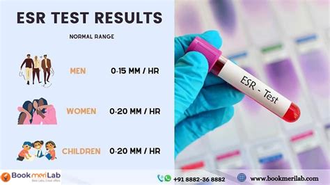 ESR Test Price Normal Range Procedure Risk Results