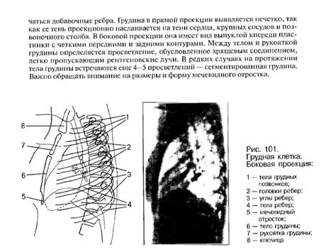 Частная остеология строение и возрастные особенности черепа рентгенанатомия костей презентация