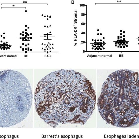 Hla Dr Expression Is Upregulated In Esophageal Tissue Early In The Download Scientific Diagram
