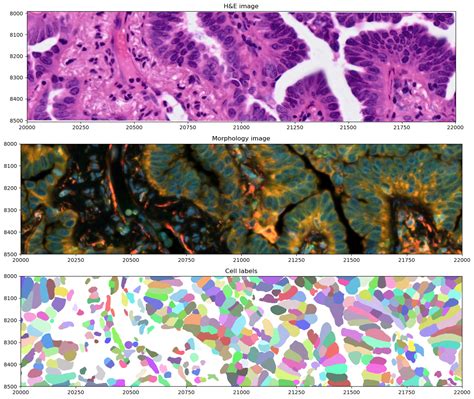 Technology Focus Xenium — Spatialdata