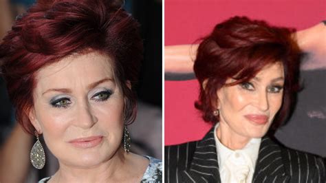 Sharon Osbourne Shares Worrying Ozempic Side Effects She Experienced