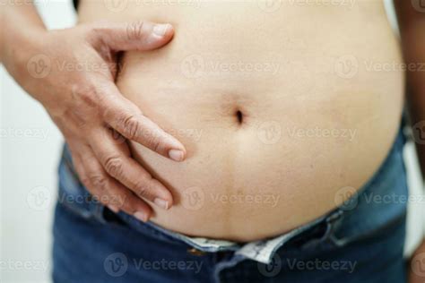 Asian Woman Show Fat Belly Big Size Overweight And Obesity At Office