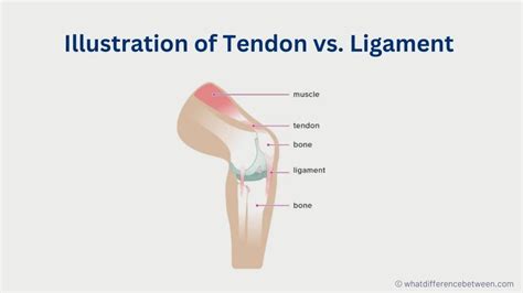 What Is The Difference Between Tendon And Ligament