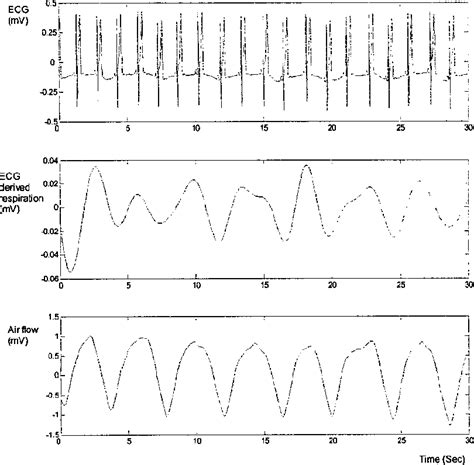 Figure 1 From Derivation Of Respiration From Ecg Measured Without Subjects Awareness Using