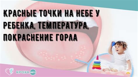 Красные точки на небе у ребенка температура покраснение горла Youtube