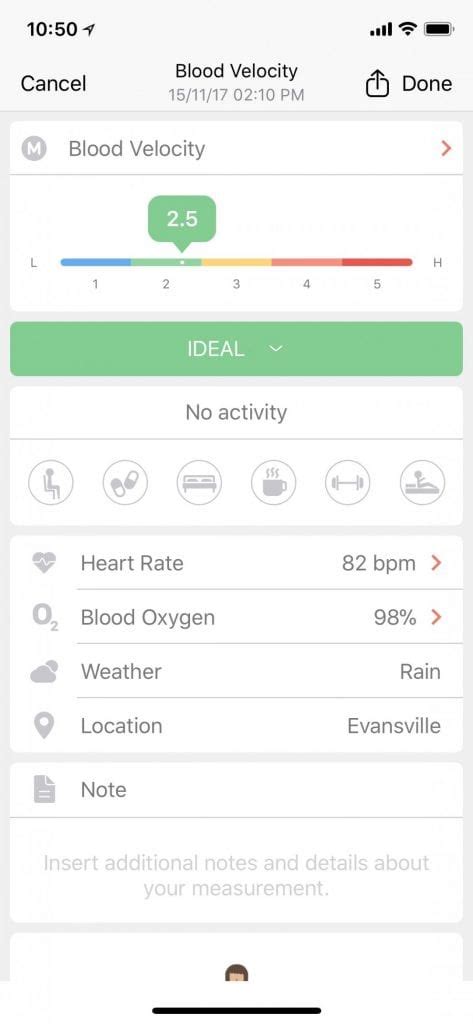 Mocaheart Monitor Review A Vital Signs Monitor In Your Pocket Macsources