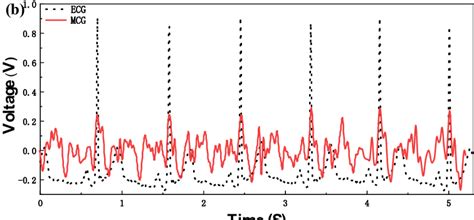 X Component Of MCG Signal Measured Using The TMR Sensor And The Download Scientific Diagram