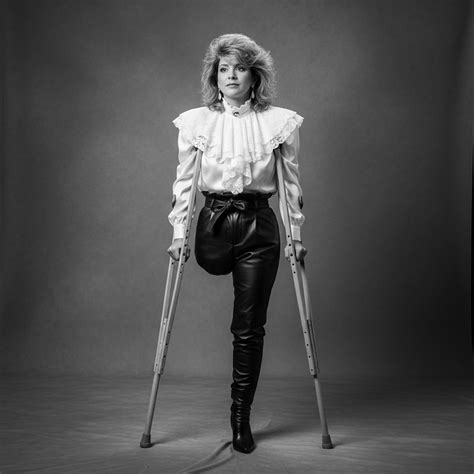 Amputee Model By Shakal1973 On Deviantart