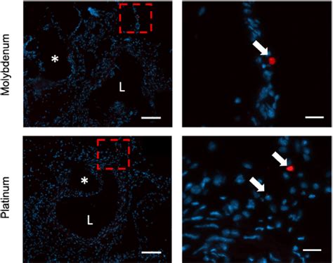 DAPI Staining Blue Of Mcherry Mouse Arterial Cross Sections