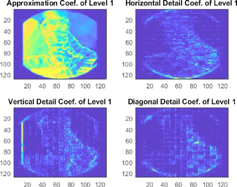 Figure 2 From Stationary Wavelet Transform Based Semi Blind Medical Image Watermarking