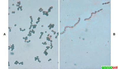 Microbiology Atlas Of Streptococcus Enterococcus And Other Catalase