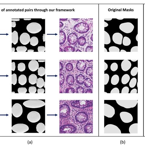 Visual Results Of Generated Colorectal Tissue Images Along With Their Download Scientific