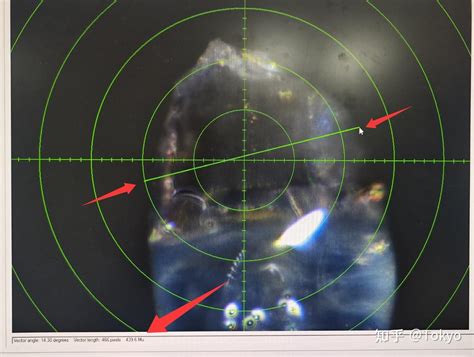 晶体测试案例56 手性化合物 钼靶 知乎