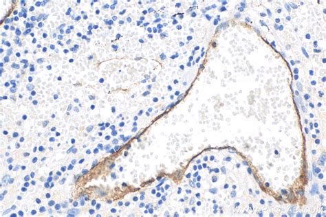 E Selectin Cd62e Antibody 30205 1 Ap Proteintech 武汉三鹰生物技术有限公司