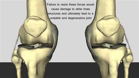 The Normal Function Of The Anterior Cruciate Ligament Youtube
